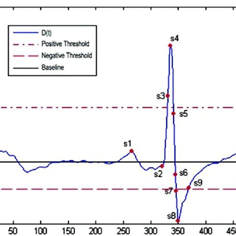 Data Structure Of QRS Complex QRS COMPLEX Download Scientific Diagram