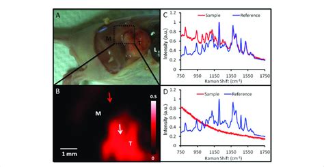 Identification Of Tumor Margins Using Sers Imaging A Image Of A