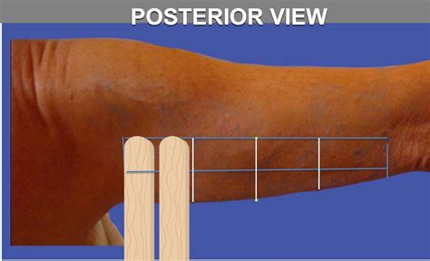 Arm Lift Technics For Female Arm Lift