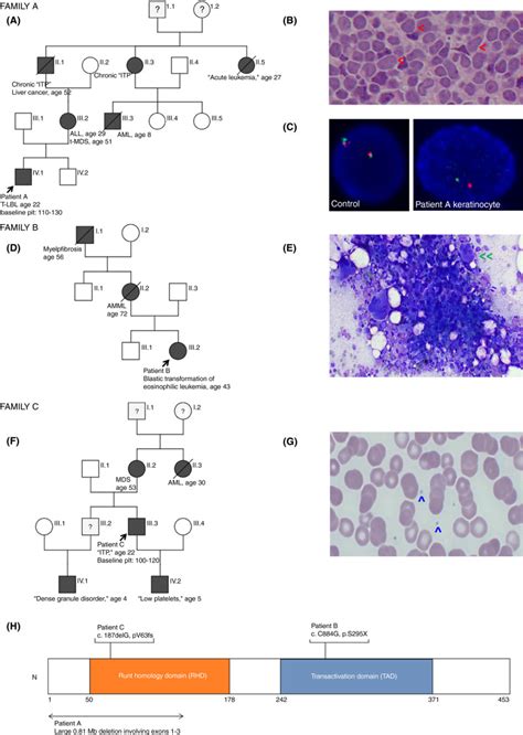 The Clinical Heterogeneity Of Runx1 Associated Familial Platelet