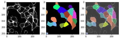 Post Processing For Membrane Based Cell Segmentation — Bio Image Analysis Notebooks