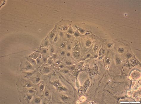 177 Questions With Answers In Caco 2 Cells Science Topic