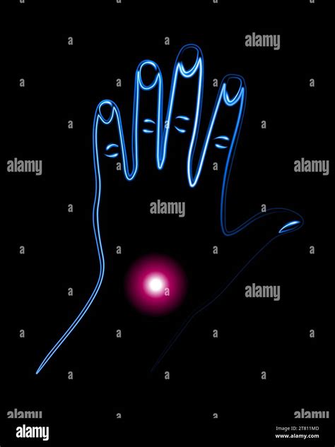 Vector Isolated Illustration Of Wrist Pain Hand With Localization Of