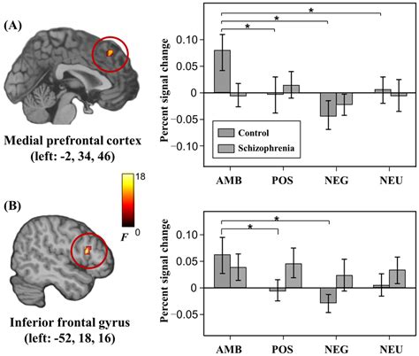 Brain Regions Showing Significant Group×condition Interaction And