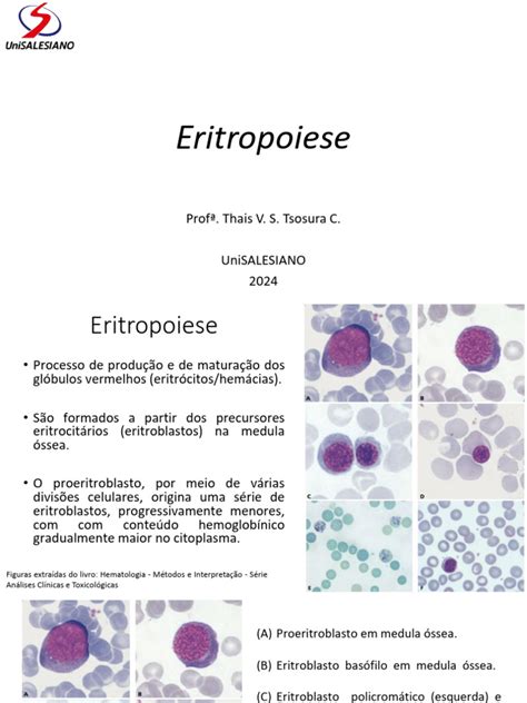 Aula 4 Eritropoiese Pdf Hemácia Especialidades Médicas