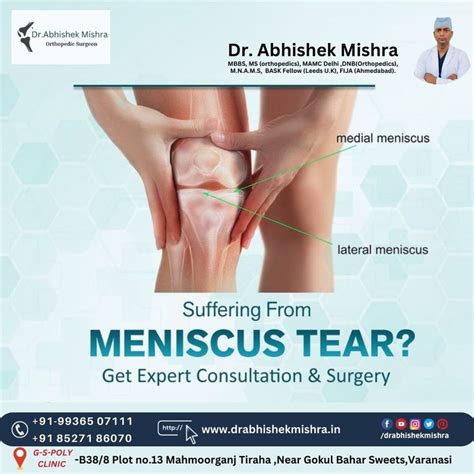 pin on dr abhishek mishra