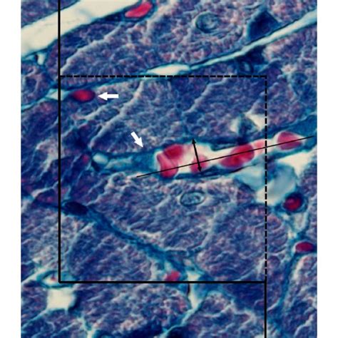 Point Counting Method To Estimate The Volume Density Of The Connective