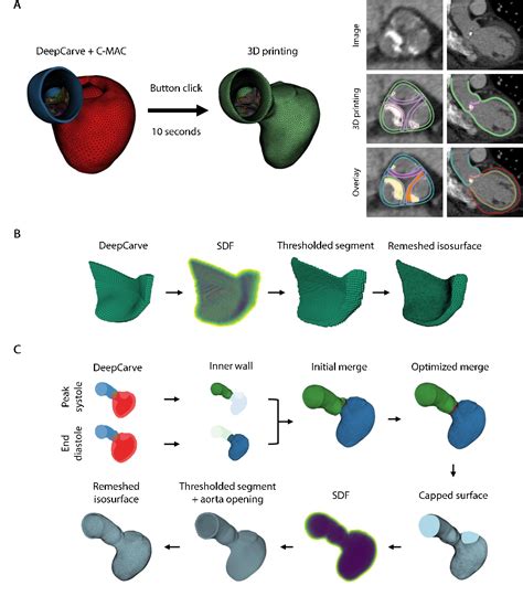 Ai Powered Multimodal Modeling Of Personalized Hemodynamics In Aortic Stenosis