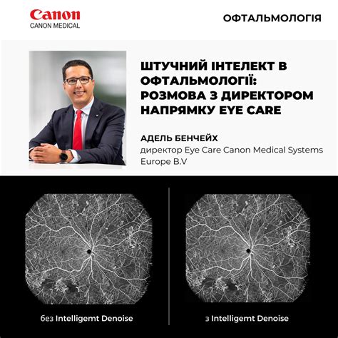 Штучний інтелект в офтальмології