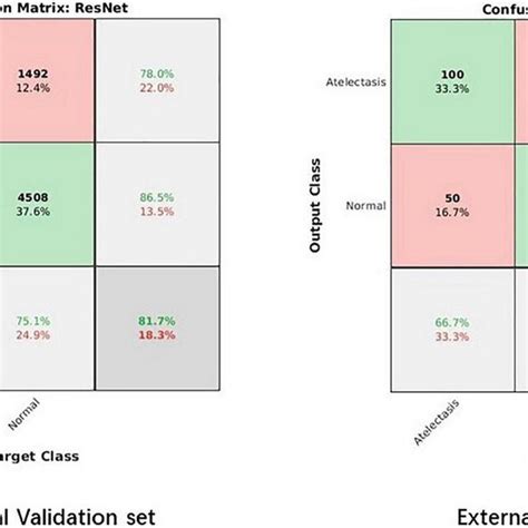 the auc diagram of the internal and external validation sets