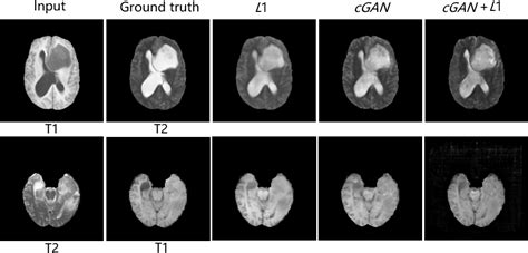 Figure From MRI Image To Image Translation For Cross Modality Image Registration And