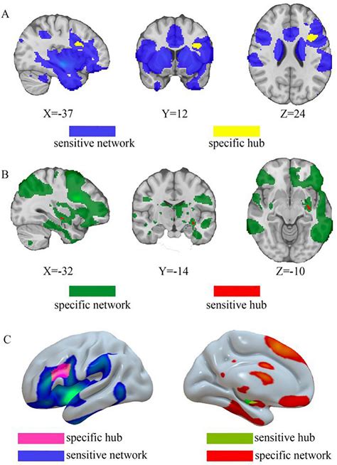 Relationship Between Sensitive Hub And Specific Hub A Sensitive