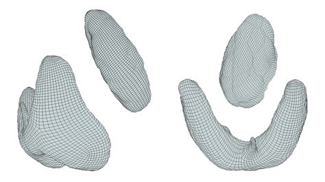 Healthy Thyroid And Thyroid Cancer 3d Model