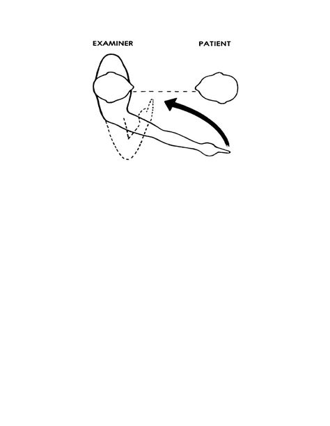 Figure 1 3 Confrontation Method Nursing Care Sensory And
