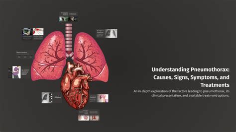 Understanding Pneumothorax Causes Signs Symptoms And Treatments By