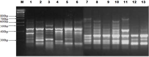 Representative Gel Showing Banding Profiles By Eric Pcr Analysis In