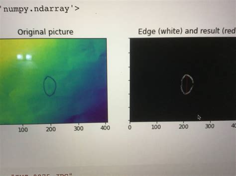 Computer Vision How To Remove Eyelashes Noise Using Ellipse Detection