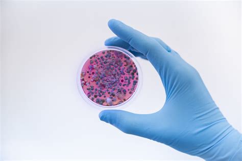 Sexually Transmitted Fungal Infection First Case Reported U S