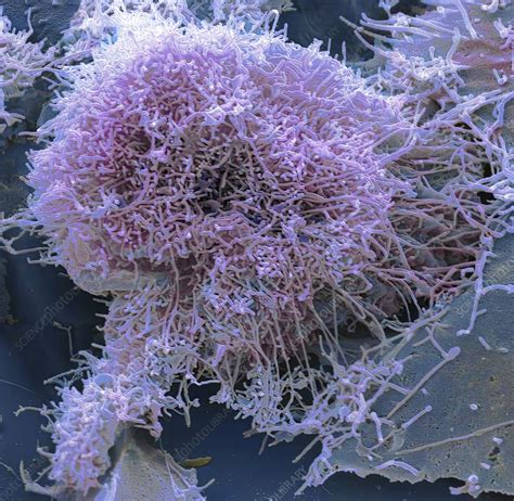 Ebola Virus Sem Stock Image C0608415 Science Photo Library