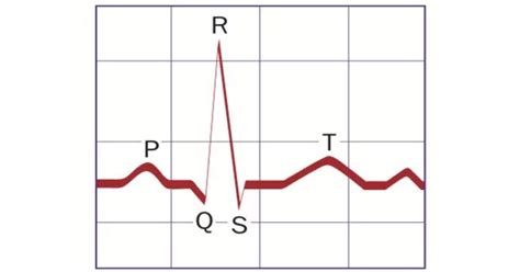 P Wave In Seismology Assignment Point