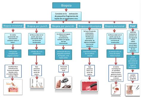 Tipos de biopsias que debes conocer