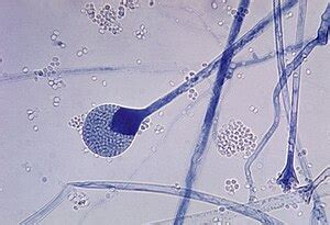 Sporangium Wikipedia