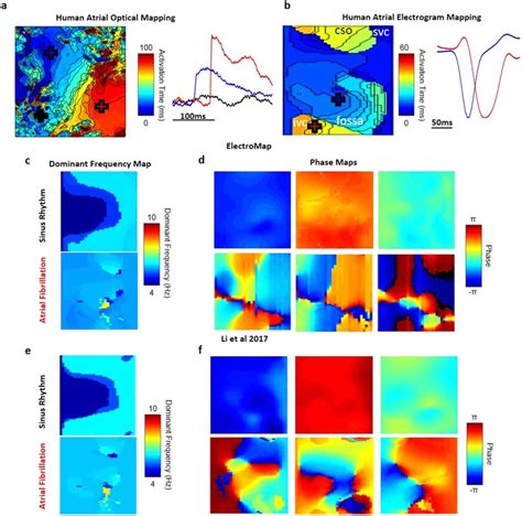 Human Atrial Optical And Electrogram Mapping Analysis A Activation