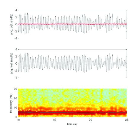 Estimation Of Instantaneous Tremor Parameters During A Postural Task