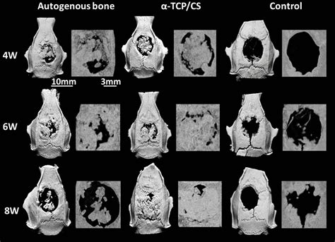 Figure 1 From Evaluation Of Bone Regeneration By Porous Alpha Tricalcium Phosphateatelocollagen