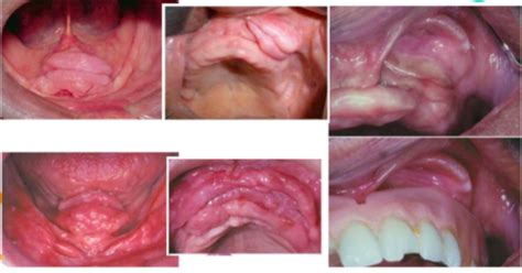 O Path Final Flashcards Quizlet