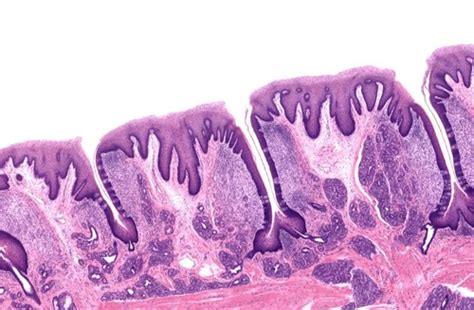 Lab 3 Flashcards Quizlet