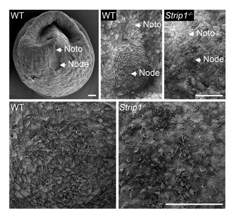 Visualizing The Node And Notochordal Plate In Gastrulating Mouse Embryos Using Scanning Electron
