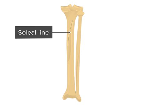 Curved Tibia Fibula Curved Tibia Fibula