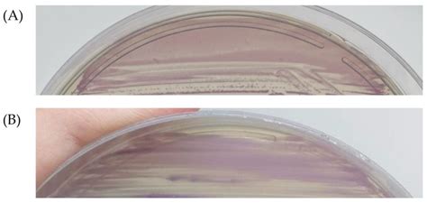 Anovaginal Colonization By Group B Streptococcus And Streptococcus Anginosus Among Pregnant