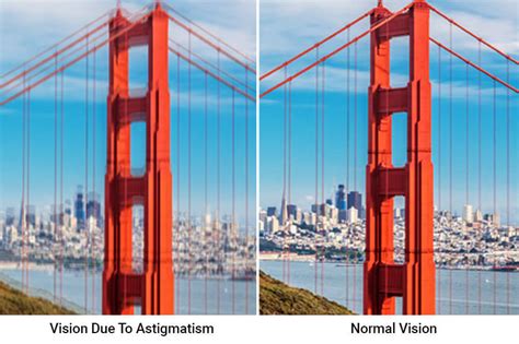 Cloudy Vision Vs Blurry Vision Causes And Differences