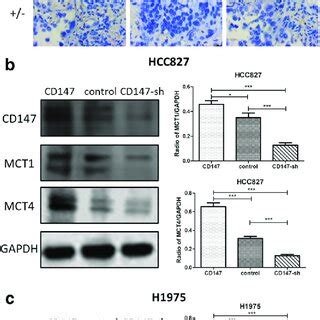 (a) Representative IHC images of CD147 and MCT1/4. (b) MCT1 and MCT4 ...