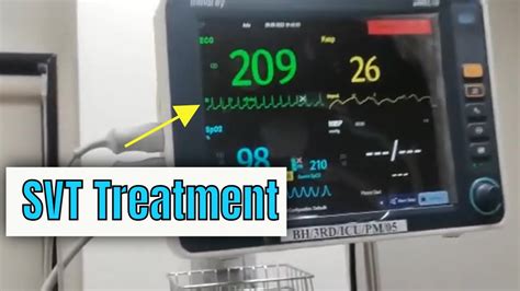 Video Thumbnail Adenosine In Supraventricular Tachycardia Svt How To Administer And How It