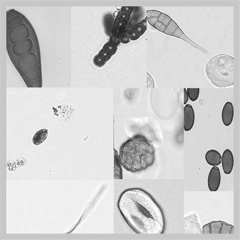 Mould Spore Trap Analysis Sysco Environmental
