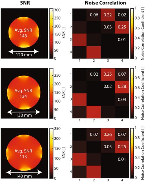 Coil Array SNR Performance When Stretched Around Phantoms Of Increasing Download Scientific