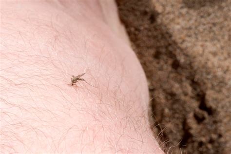 Premium Photo A Spider On A Leg With The Leg Of A Person