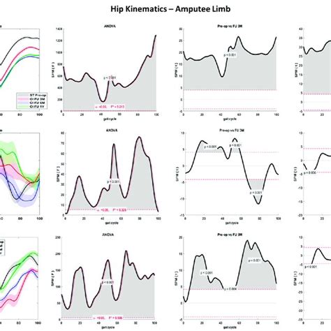 hip joint kinematics for the amputee limb over the percentage of the