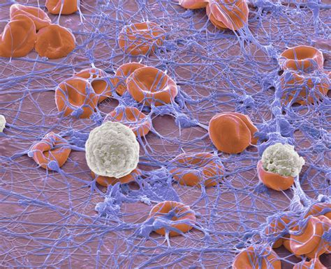 Picc Line Internal Surface Sem Stock Image C057 5304 Science