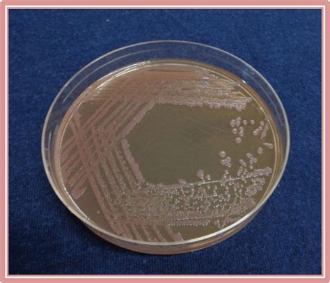 2 The Culture Appearance Of Acinetobacter Baumannii Colonies On Download Scientific Diagram
