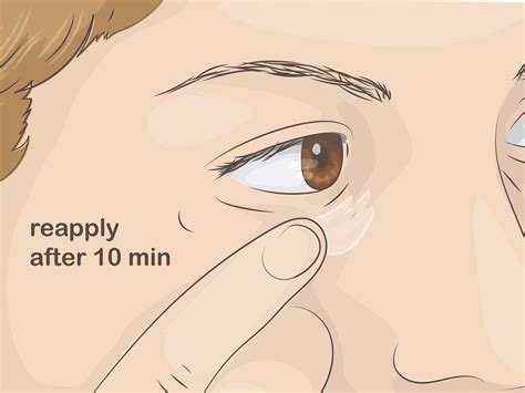 How To Apply Plexaderm 10 Steps With Pictures Wikihow