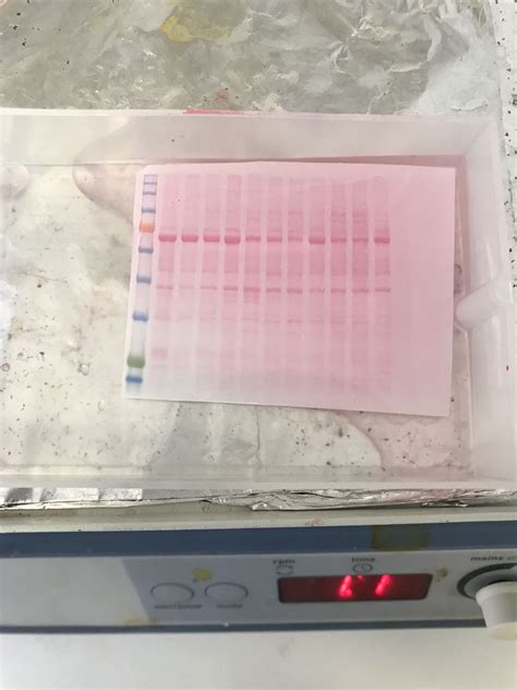 127 Questions With Answers In Bca Assay Scientific Method