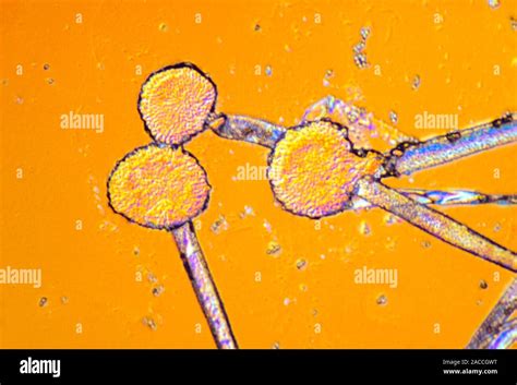 Light Micrograph Of Aspergillus Flavus A Fungus Found In Soil Which