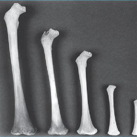 Showing Bicondylar Angle Download Scientific Diagram