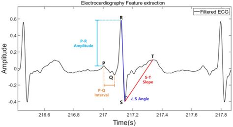 Intelligent Feature Selection For Ecg Based Personal Authentication Using Deep Reinforcement