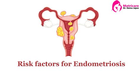 Risk Factors For Endometriosis