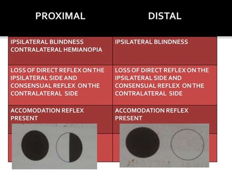 Visual Pathway And Its Defects Pptx